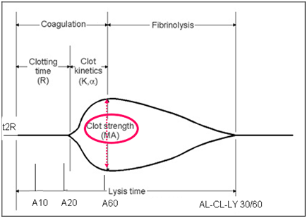 What is thromboelastography and how it works in the TEM-A. – Gototema